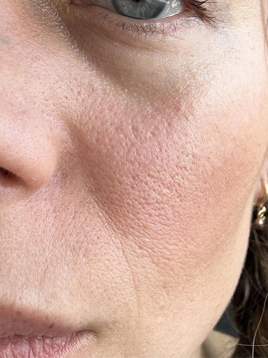 How to Shrink Large Pores Naturally: A Complete Guide – Shop Kor Beauty